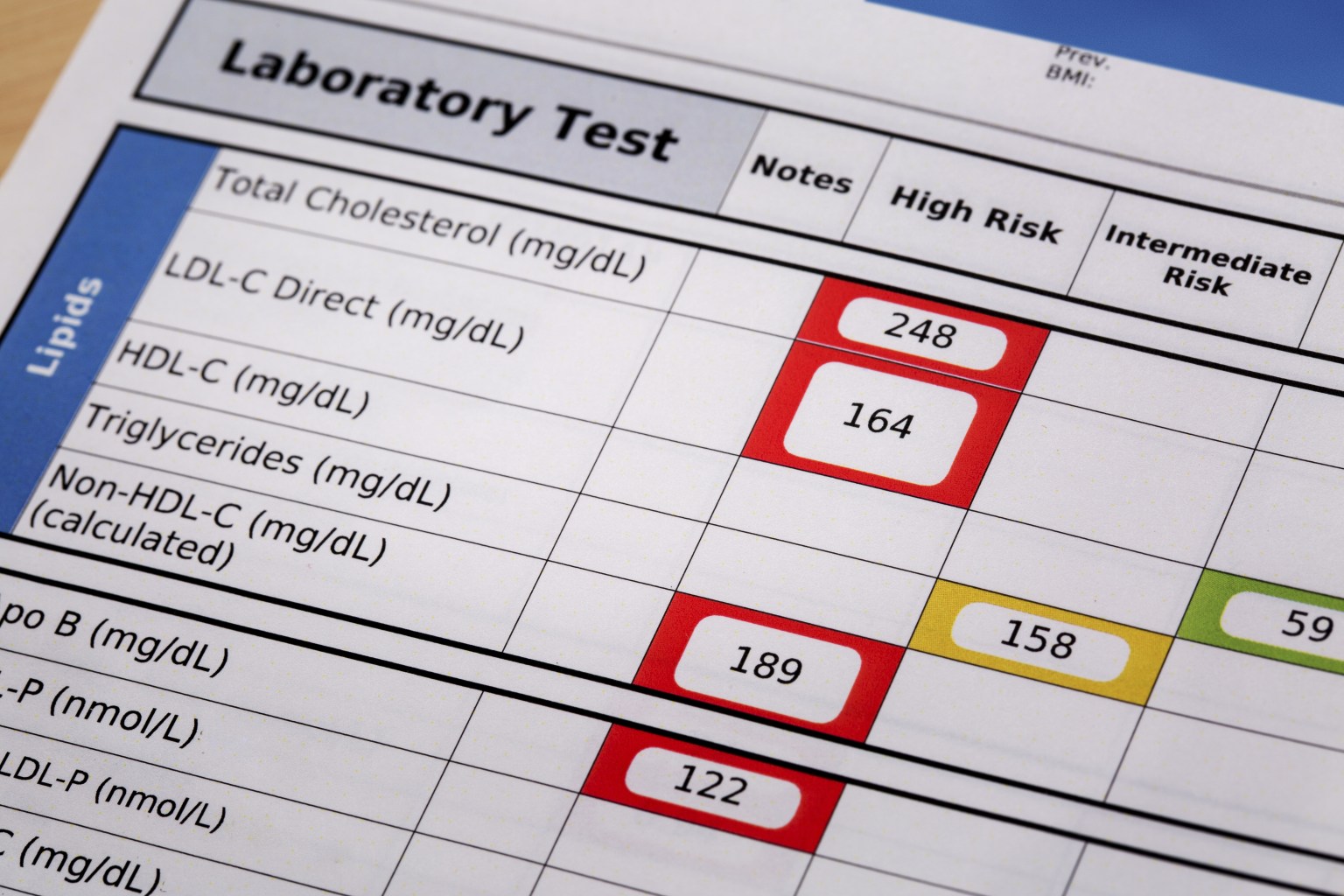 What Is LDL Cholesterol? Why It’s Not Always Bad | Dr. Berg
