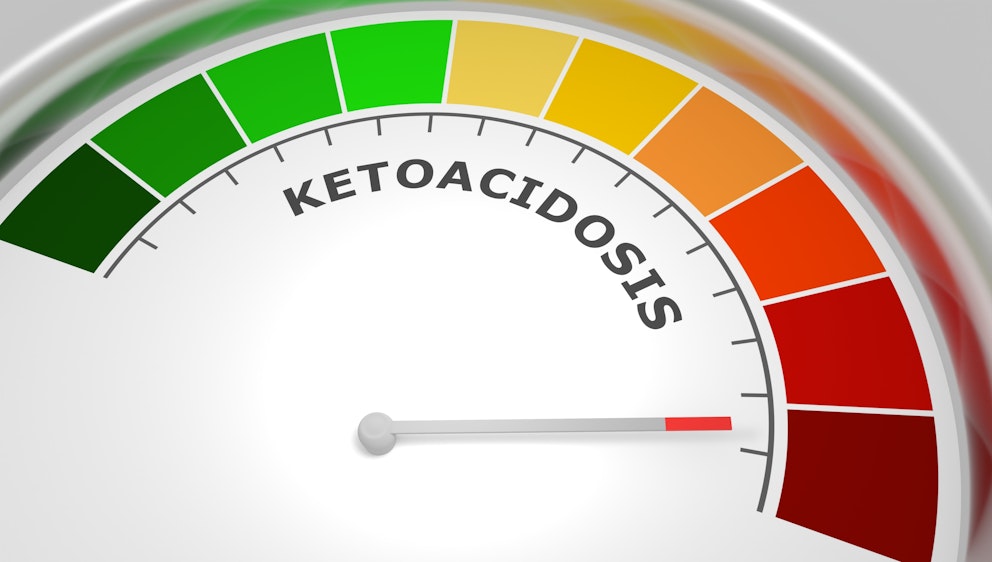 Diabetic Ketoacidosis: Signs and What to Do | Dr. Berg