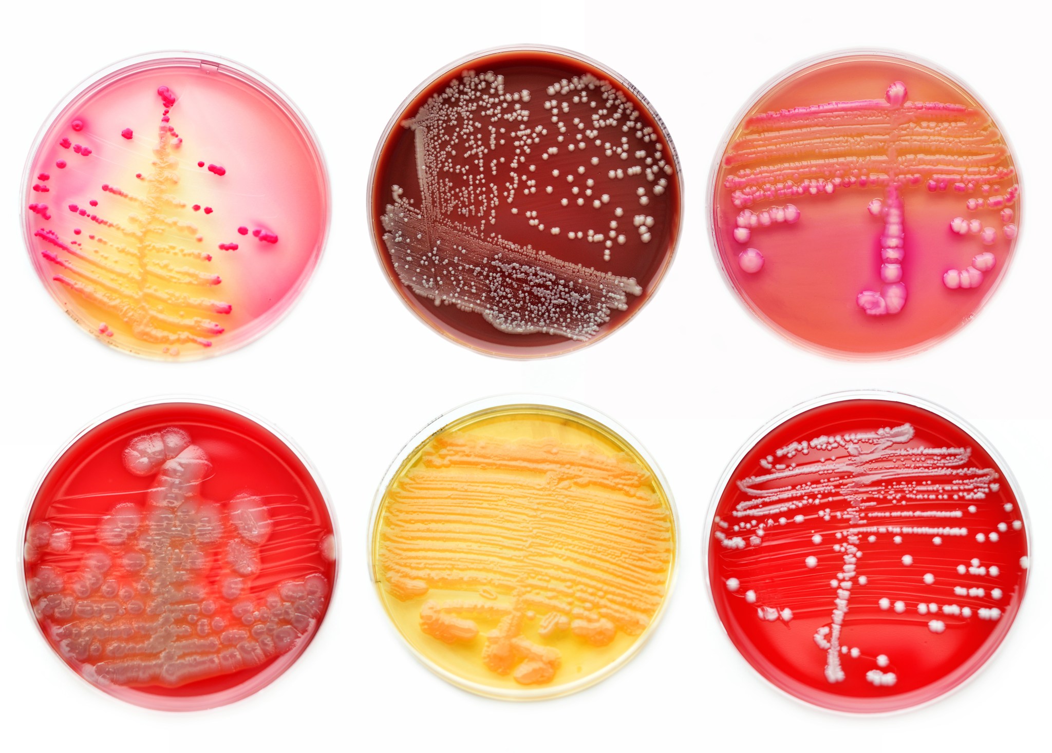 How Does Monolaurin Kill Viruses? | Dr. Berg