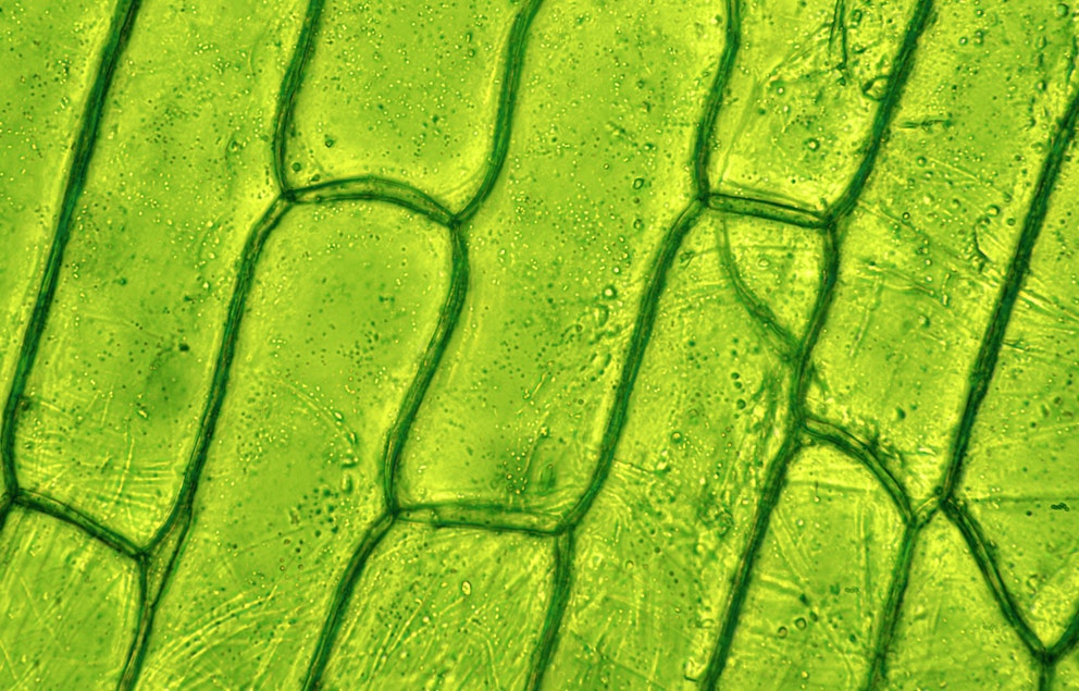 Chlorophyll Benefits for a Healthy Gut | Dr. Berg
