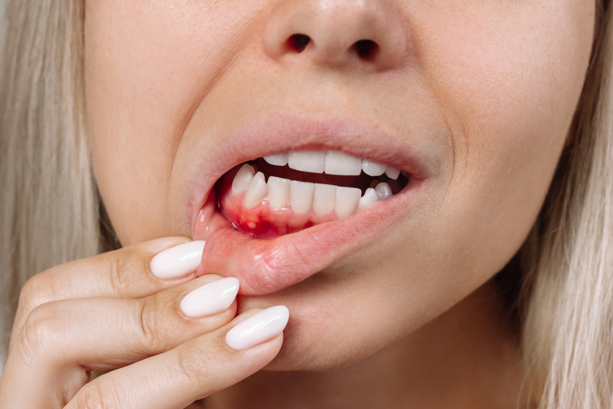 Coconut Oil Pulling Dangers Risks and Safety Tips | Dr. Berg