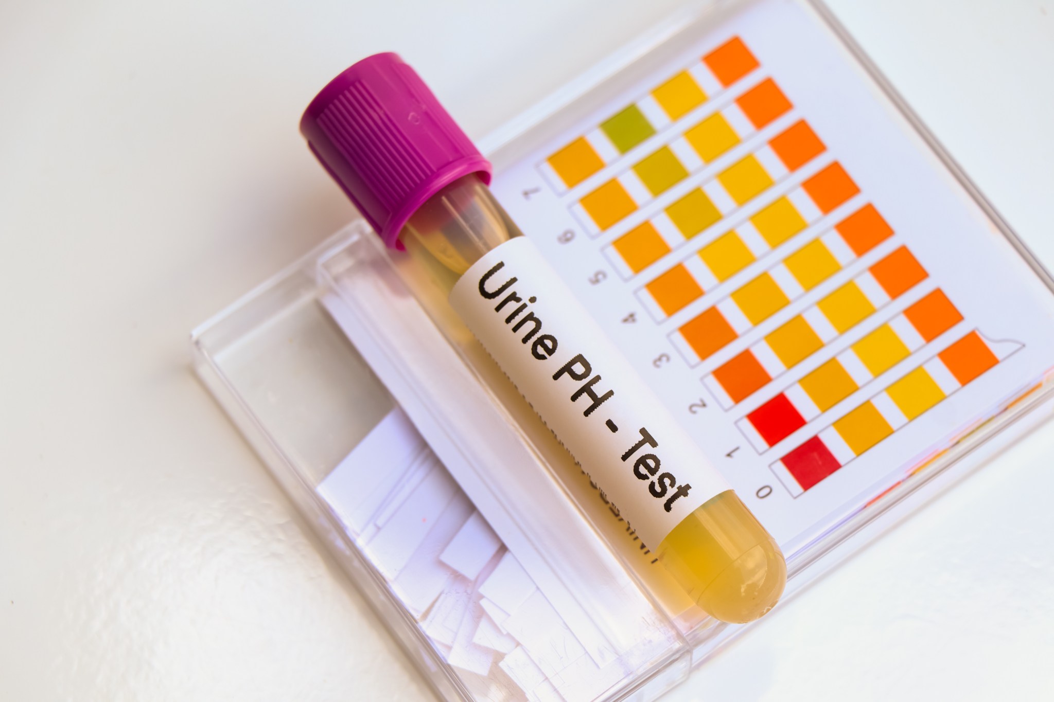High pH in Urine: Powerful Clues to Your Health | Dr. Berg