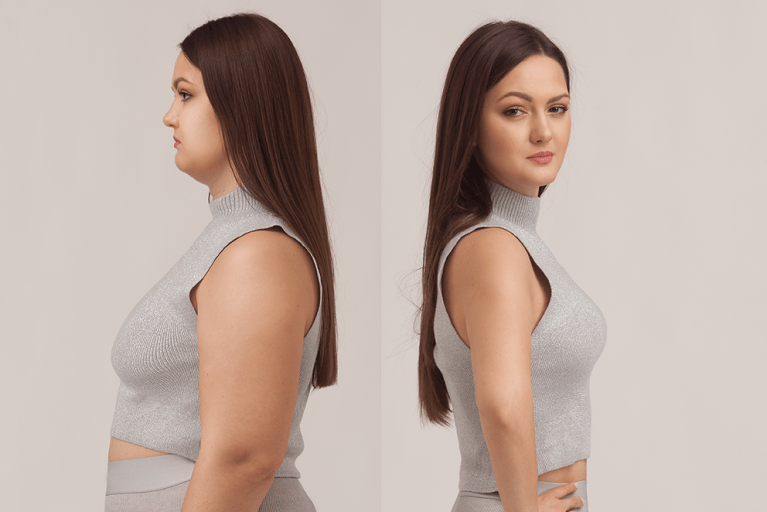 Keto Success Story: My Health Transformation - Dr. Berg