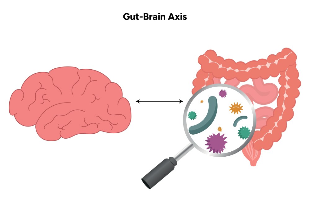 Gut Brain Connection: The Key to Wellness | Dr. Berg