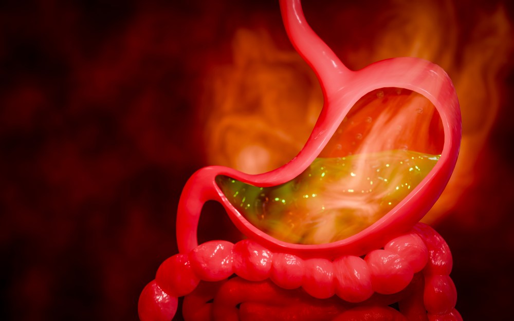 GERD Diet: What to Eat for Heartburn Relief | Dr. Berg